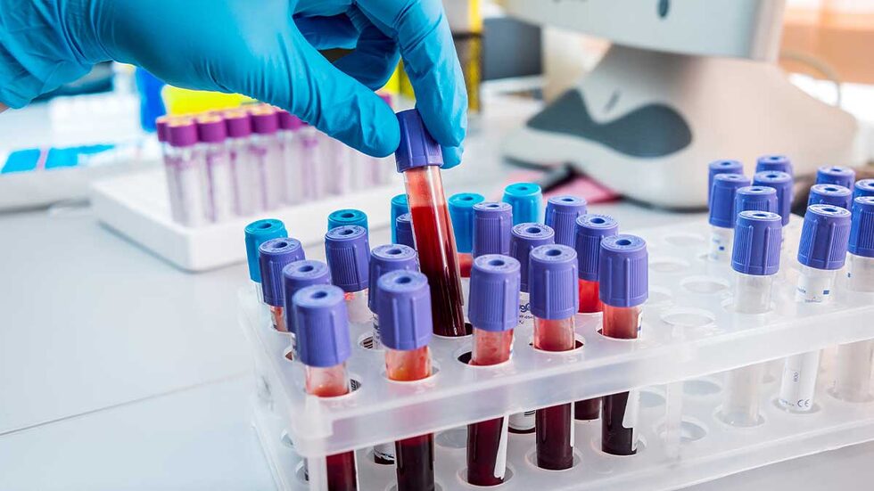 Forensic Access Group Rebrands as Analytical Expert Labs | Analytical ...